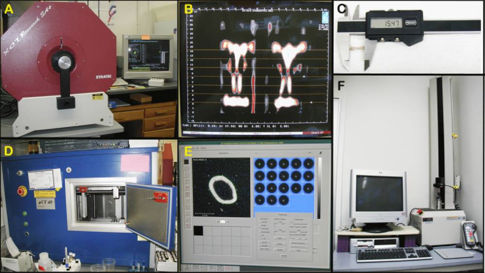 MPD: Donahue2: project protocol