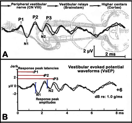 MPD: Jones1: project protocol