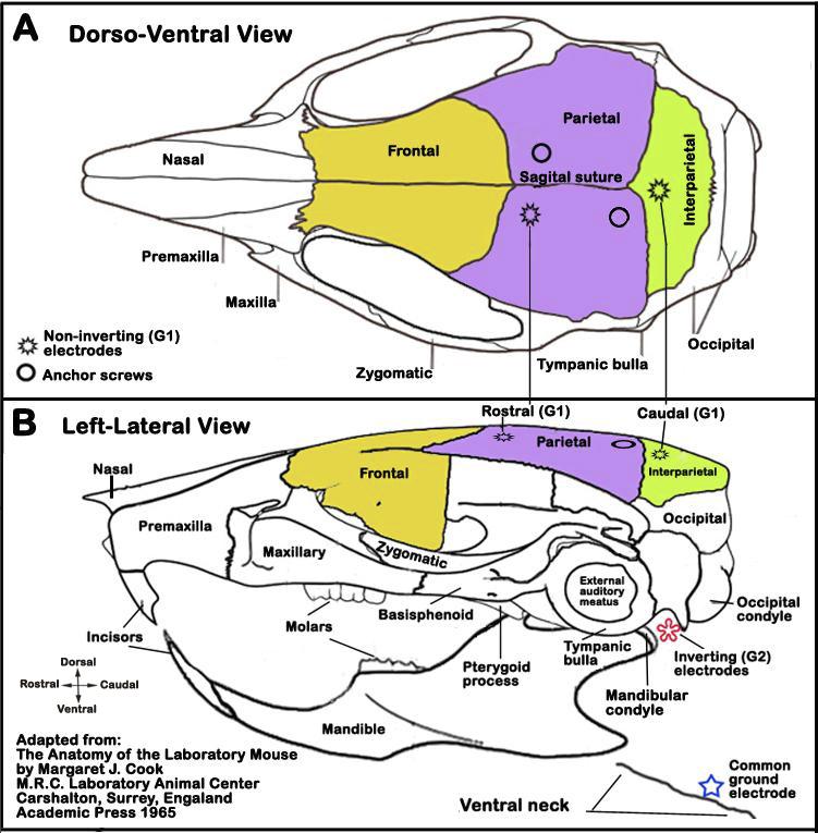 MPD: Jones1: project protocol