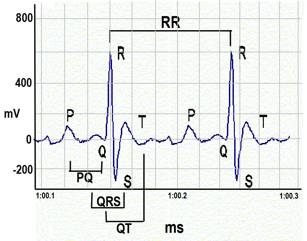 MPD: Lake1: project protocol