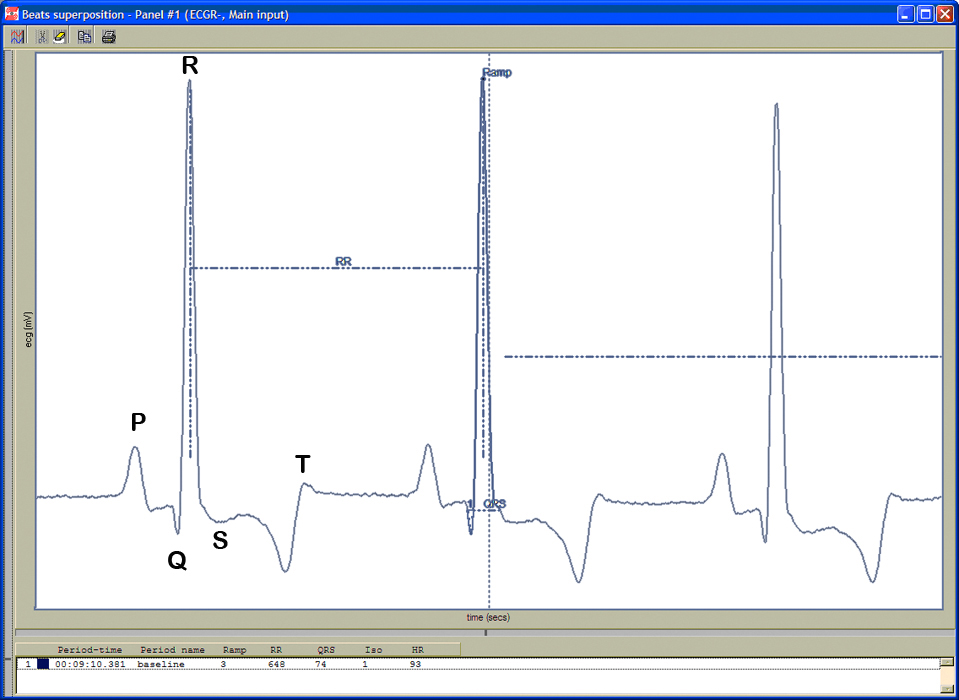 MPD: Maurer1: project protocol